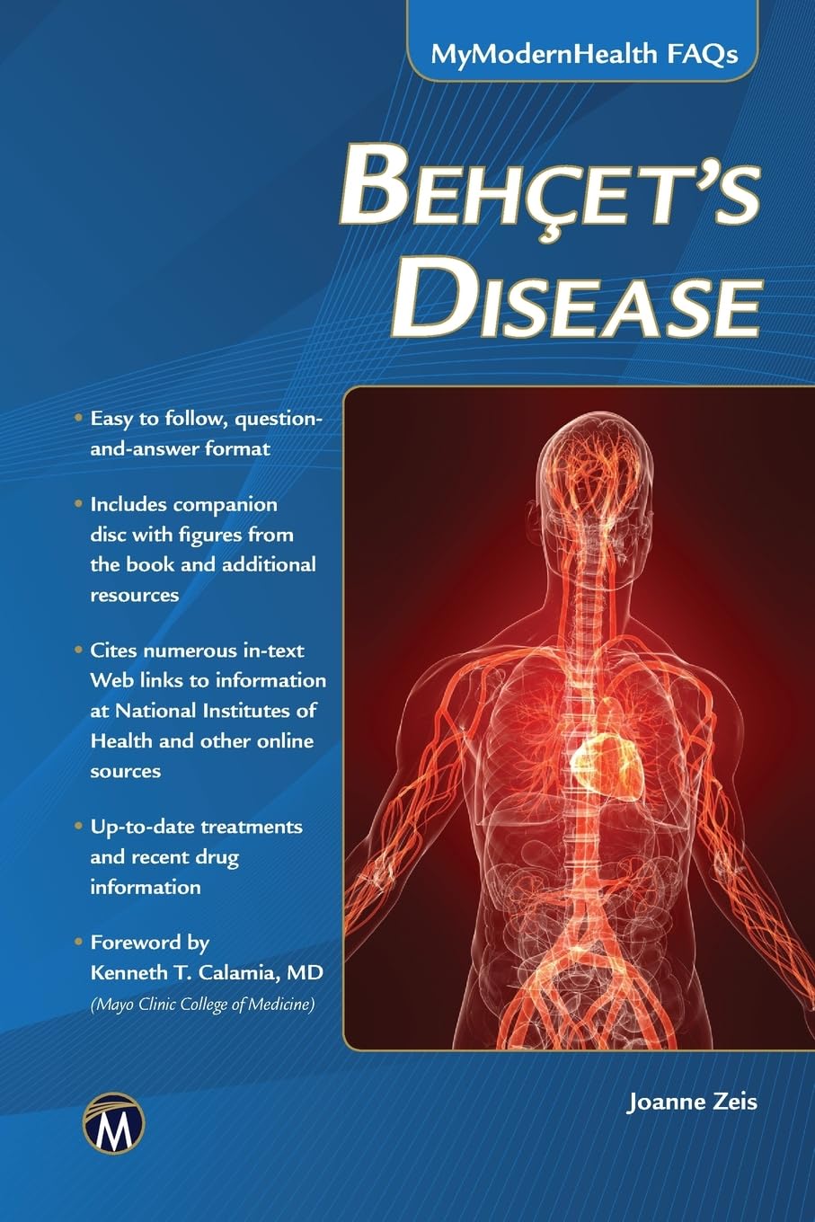 Behcet’s Disease (MyModernHealth FAQs)
