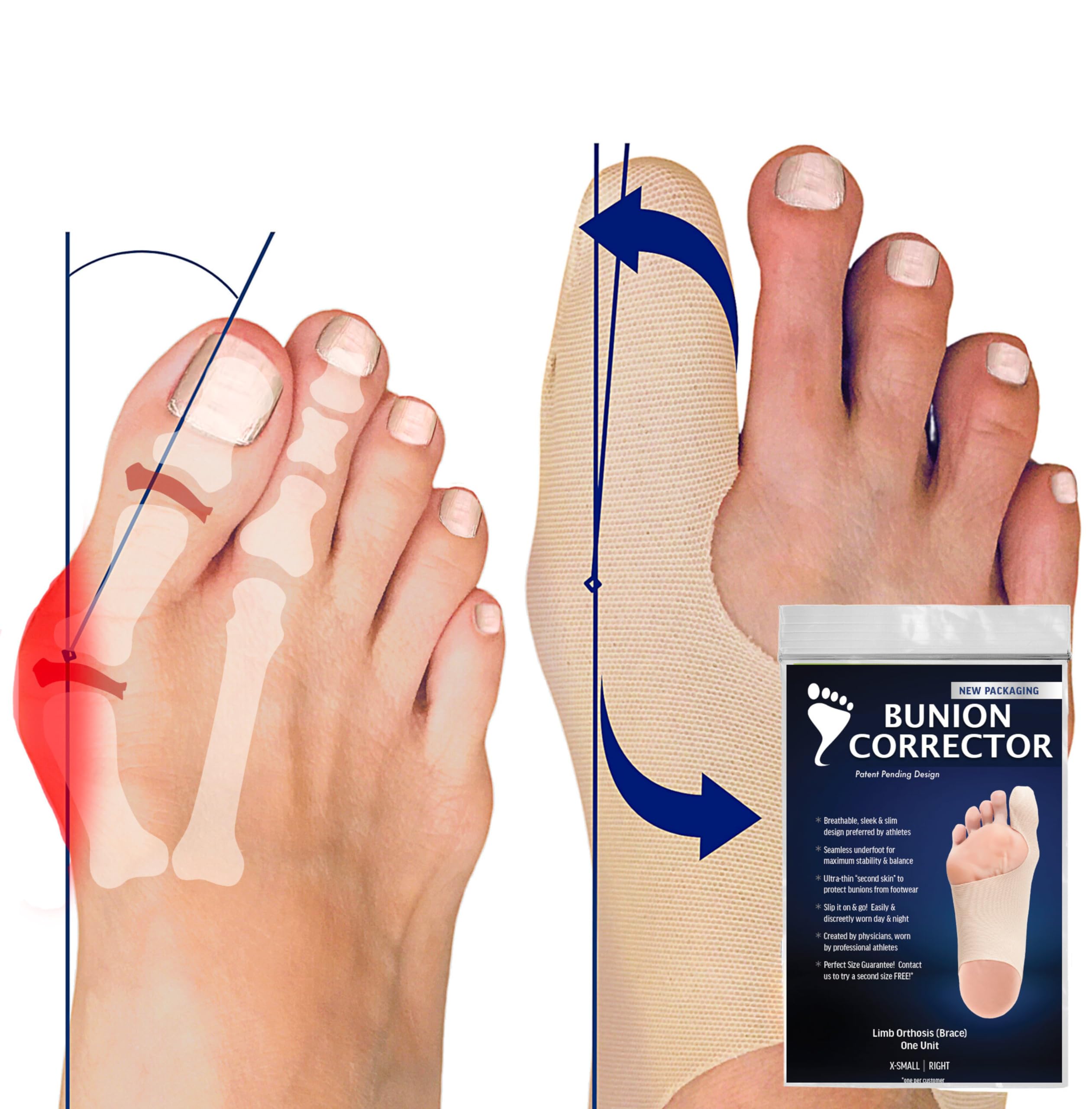 Bunion Corrector for Men & Women Big Toe Straightener for Inside Shoes Socks. Ultra Thin Hallux Valgus Socks to Separate & Straighten Great Toes. Day & Night Splints for Juanetes, X-Large-Left