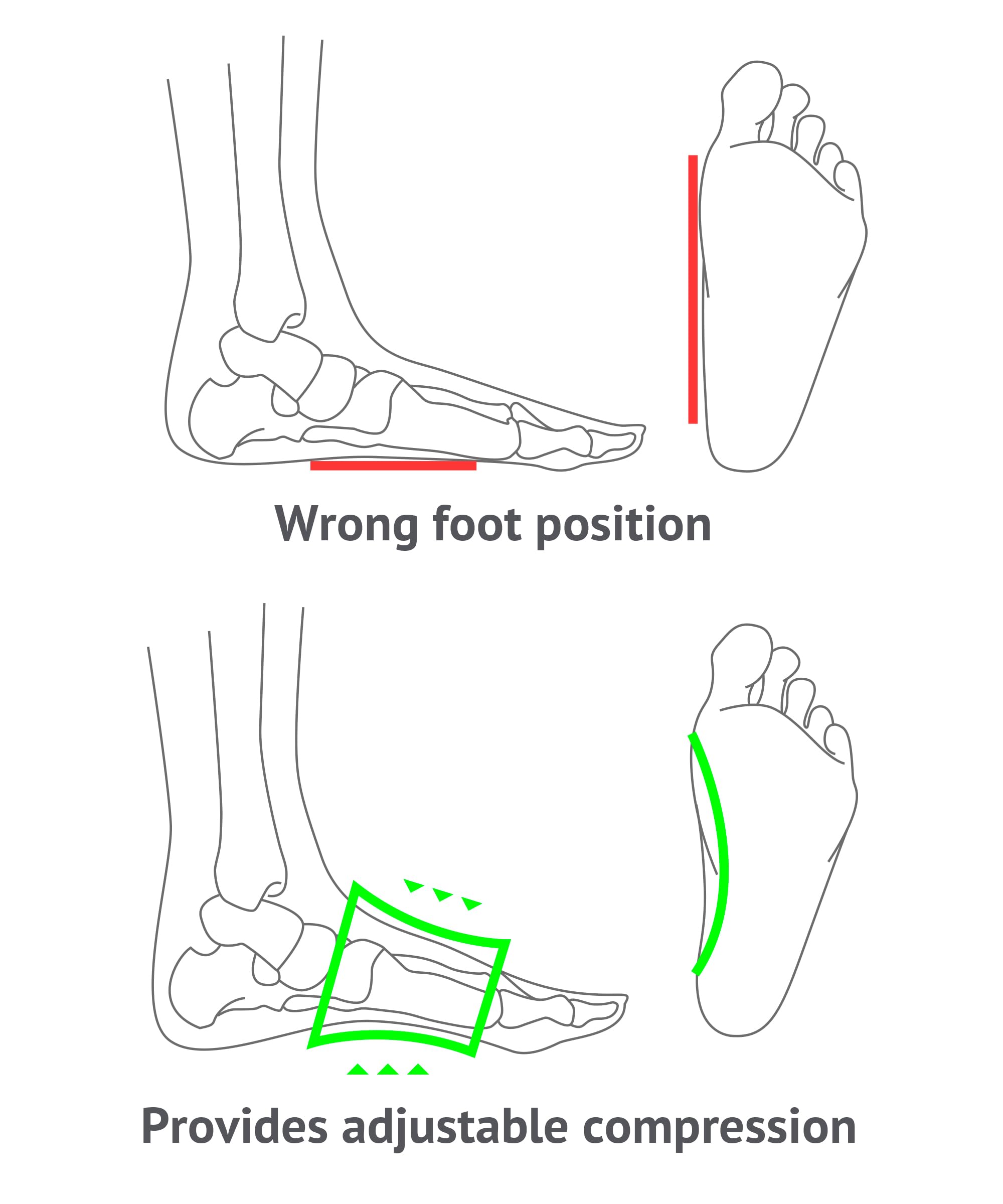 BRISON Plantar Fasciitis Relief - Arch Support Orthotics Inserts Brace - Adjustable Compression Helps with Planters Facetious Flat Foot Pain Foot Care Black