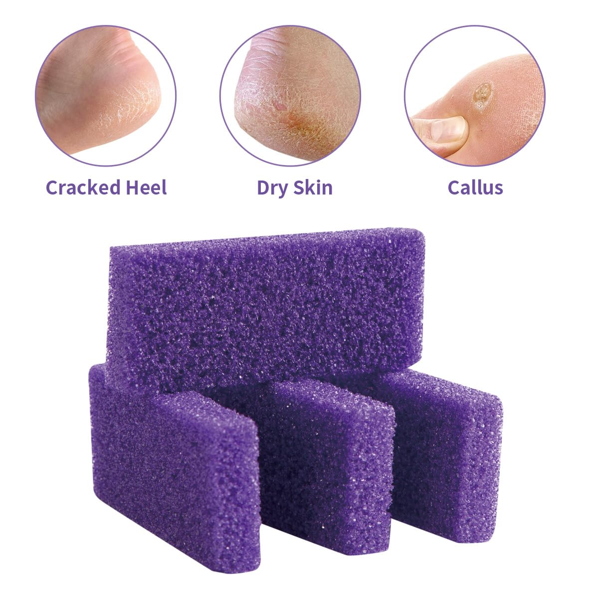 CHAOMAO Disposable Foot Scrubber Pumice Pads, Pedicure Pumice Stone Dead Skin Callus Remover for Feet