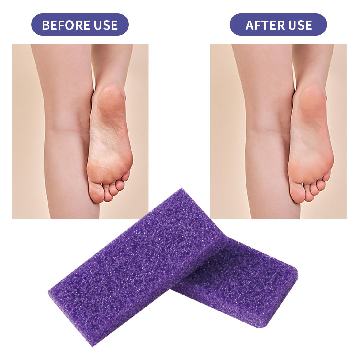 CHAOMAO Disposable Foot Scrubber Pumice Pads, Pedicure Pumice Stone Dead Skin Callus Remover for Feet