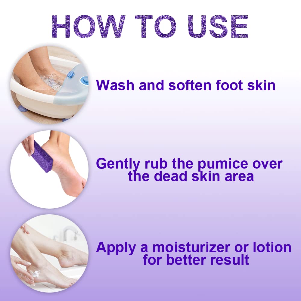 BPrettier Foot Pumice Stone Pumice Stone for Feet Foot Scrubber Sponge Callus Remover Dead Skin,Pedicure Supplies Nail Salon Home Use 40 PCS
