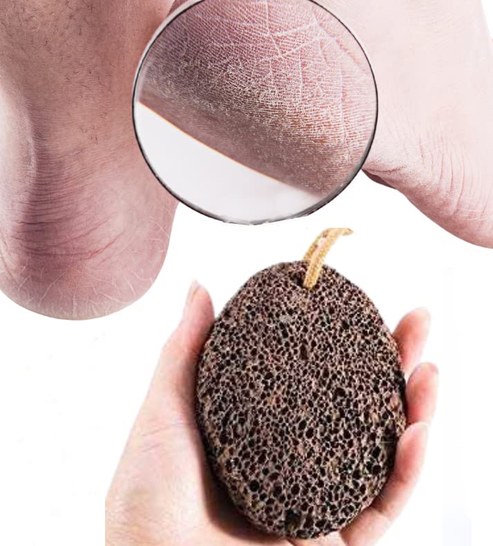 Elaj Pumice Stone Feet Scrubber - Natural Earth Lava Rock Foot Callus Remover for Smooth and Soft Feet, Exfoliates Dry, Cracked Heels & Skin, Promotes Foot Care Health, Designed for Women (Lava Rock)