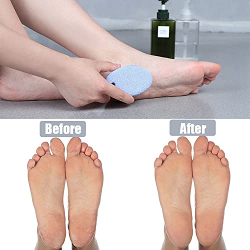 Pumice Stone 2 Pcs, Natural Lave Pumice Stone for Feet/Hand, Small Callus Remover/Foot Scrubber Stone for Men/Women by MAYKI