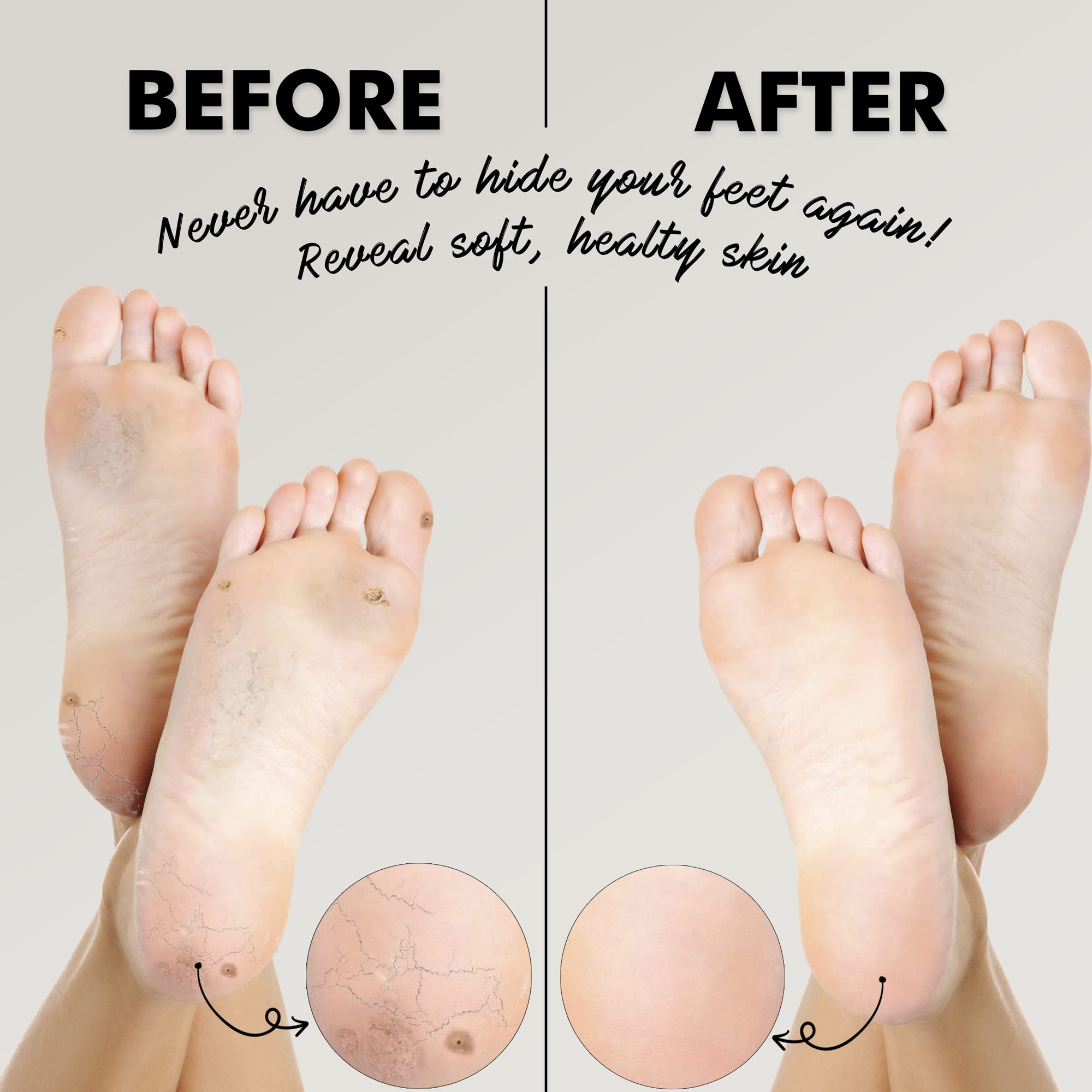 Jairestone Pumice Stone for Feet - Natural Earth Lava Pumice Stone for Foot Callus - Foot Scrubbers for Use in Shower - Pack of 2