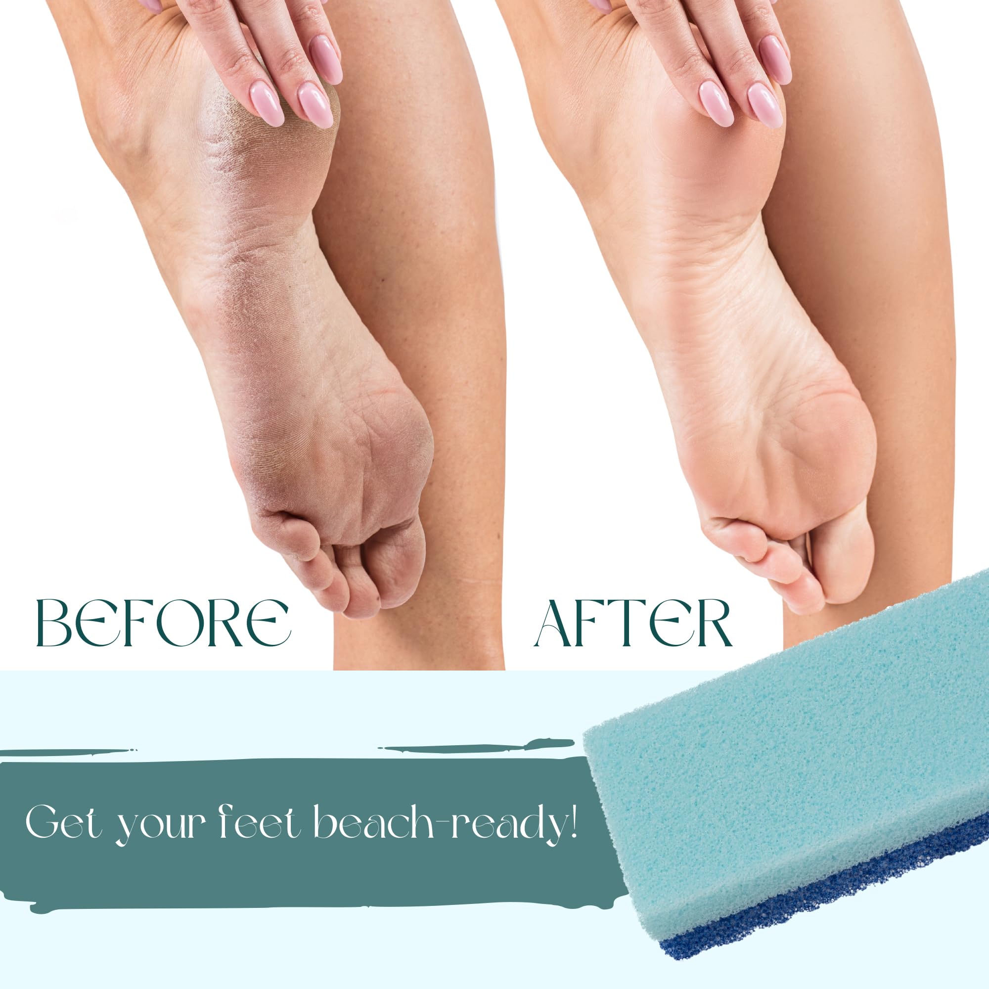 Mantello Pumice Stone for Feet- Foot Scrubbers for Shower and Foot Tub- Pumice Stone for Feet Callus Remover- Double Sided Foot Scrubber Dead Skin Remover- 4 Pack
