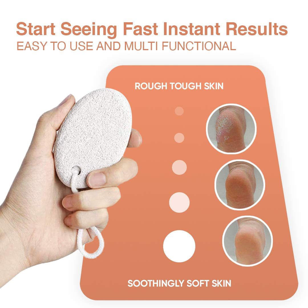 Jogi Life - (4pc) All Natural Pumice Stones | HARD Callus Remover | Premium Foot Filer Exfoliator to Remove Dead Skin |