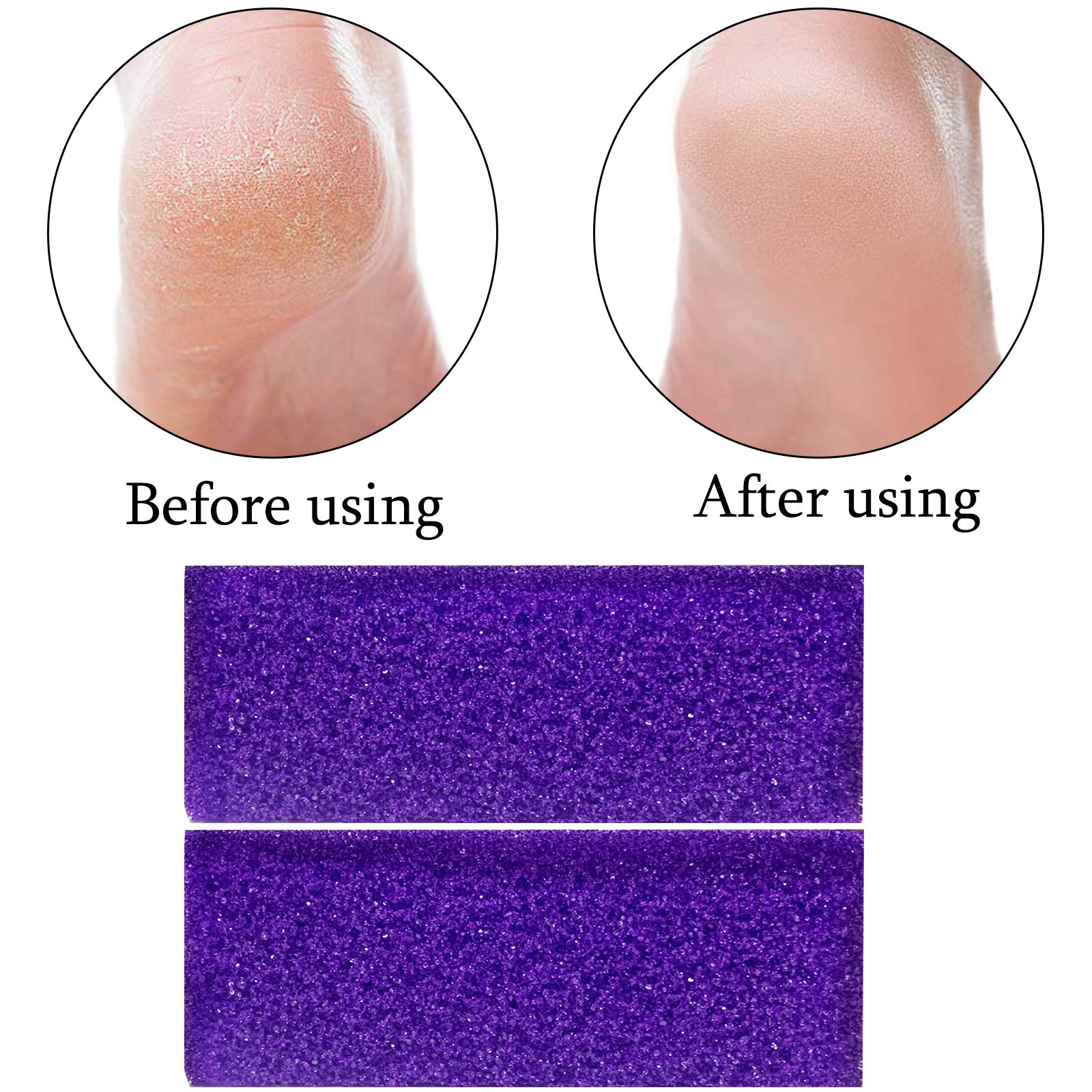 40 Pcs Pumice Stone for Feet Foot Scrubber Sponge for Feet Care and Callus Remover Mini Disposable Pumice Pads for Dead Skin Remover (Purple)