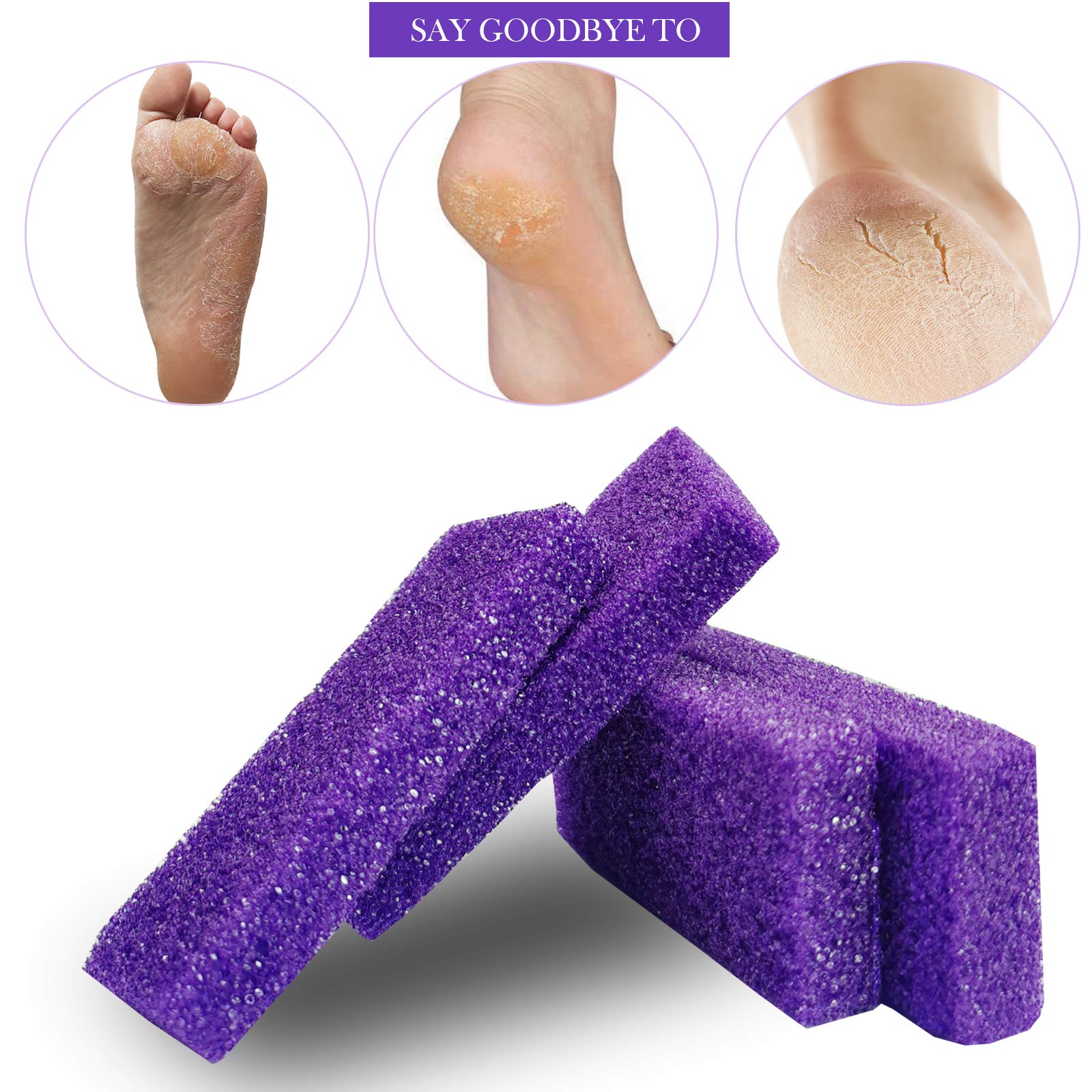 40 Pcs Pumice Stone for Feet Foot Scrubber Sponge for Feet Care and Callus Remover Mini Disposable Pumice Pads for Dead Skin Remover (Purple)