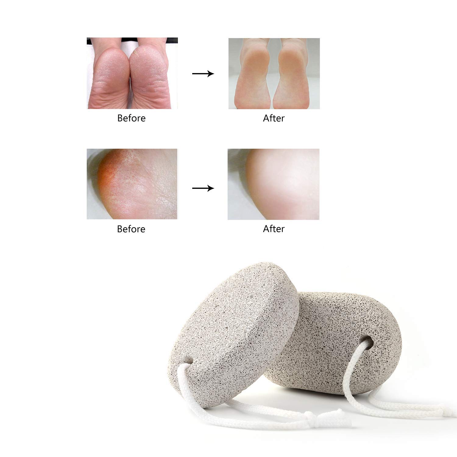 Natural Pumice Stone for Feet 2 PCS, PHOGARY Lava Pedicure Tools Hard Skin Callus Remover for Feet and Hands - Natural Foot File Exfoliation to Remove Dead Skin