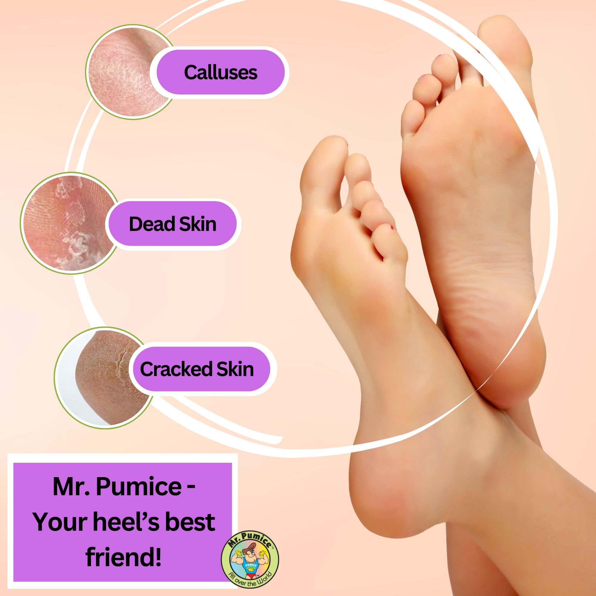 Mr. Pumice Purple PUMI Bar, Extra-Coarse Callus Remover, Pedicure Stone & Ped File Scrubber for Smooth Feet and Heels, 4 Pack