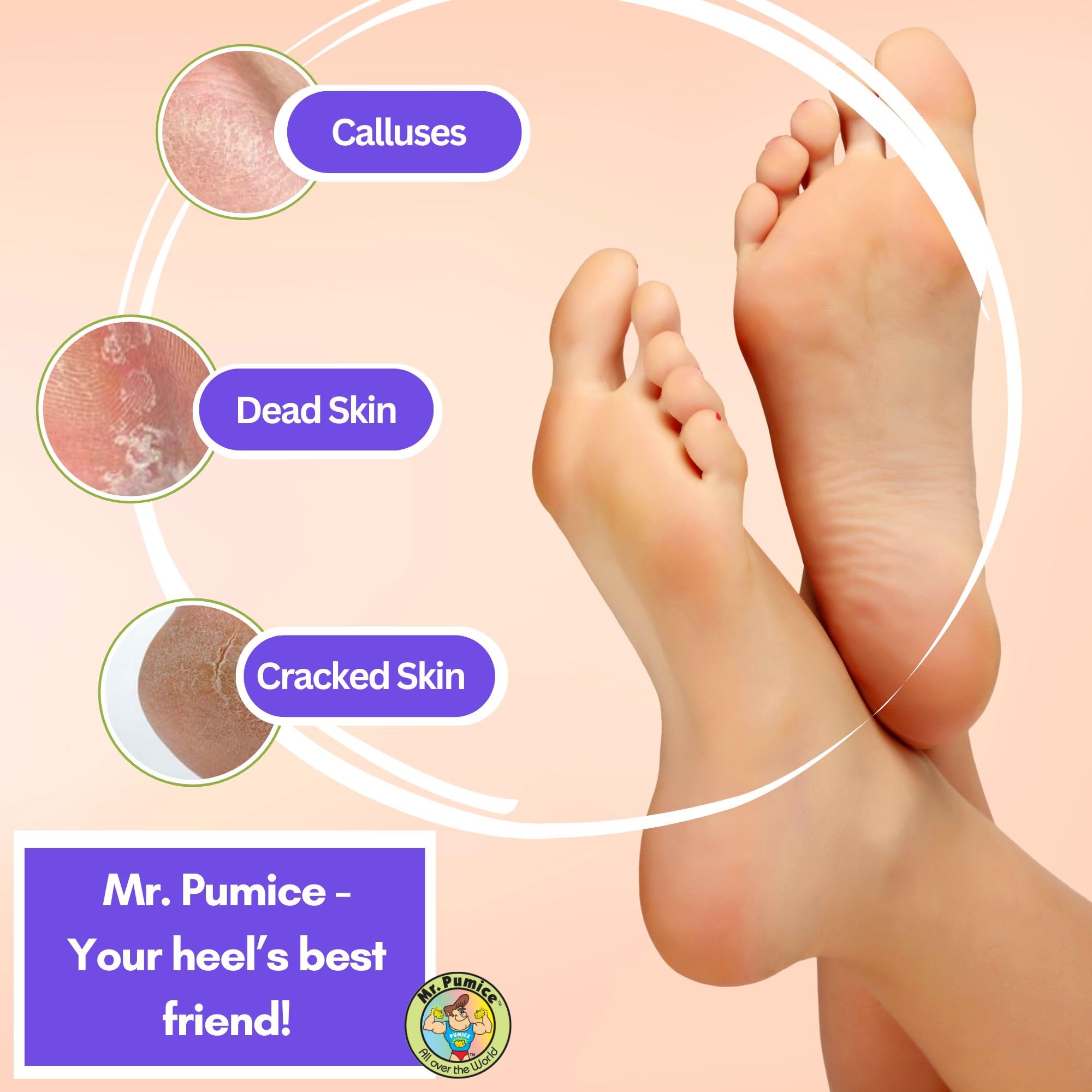 Mr. Pumice Ultimate PUMI Bar, 2-in-1 Callus Remover, Pedicure Stone & Ped File Scrubber for Smooth Feet and Heels, Dual-Grit (Medium + Coarse), 1 Pack