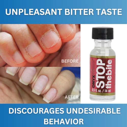 Onyx Professional Stop the Bite Nail Biting Deterrent Polish 0.5 Fl Oz - Helps Nails Grow & Can be Used as a Top or Base Coat