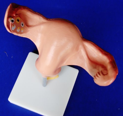 Model Anatomy Professional Medical Uterus Magnified New IT-086 ANGELUS