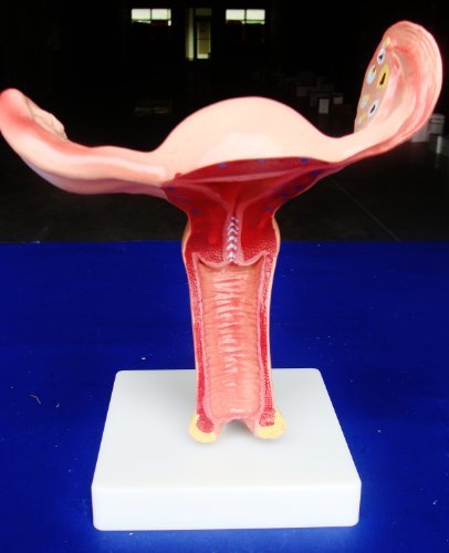 Model Anatomy Professional Medical Uterus Magnified New IT-086 ANGELUS