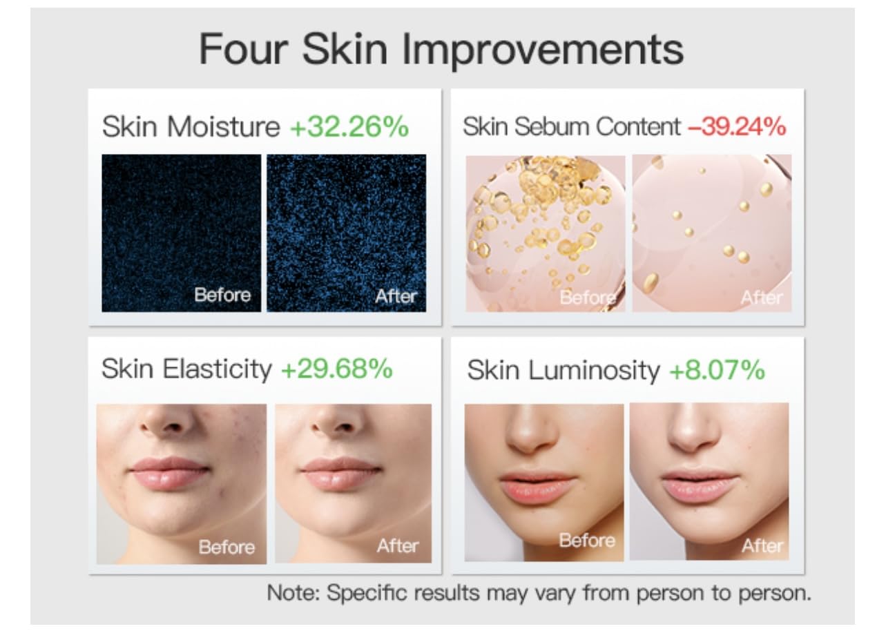 ReNew You Essentials Red Light Therapy For Face, multiple colors LED Face Mask Light Therapy, Red Light Therapy Mask Skin Care At Home Use