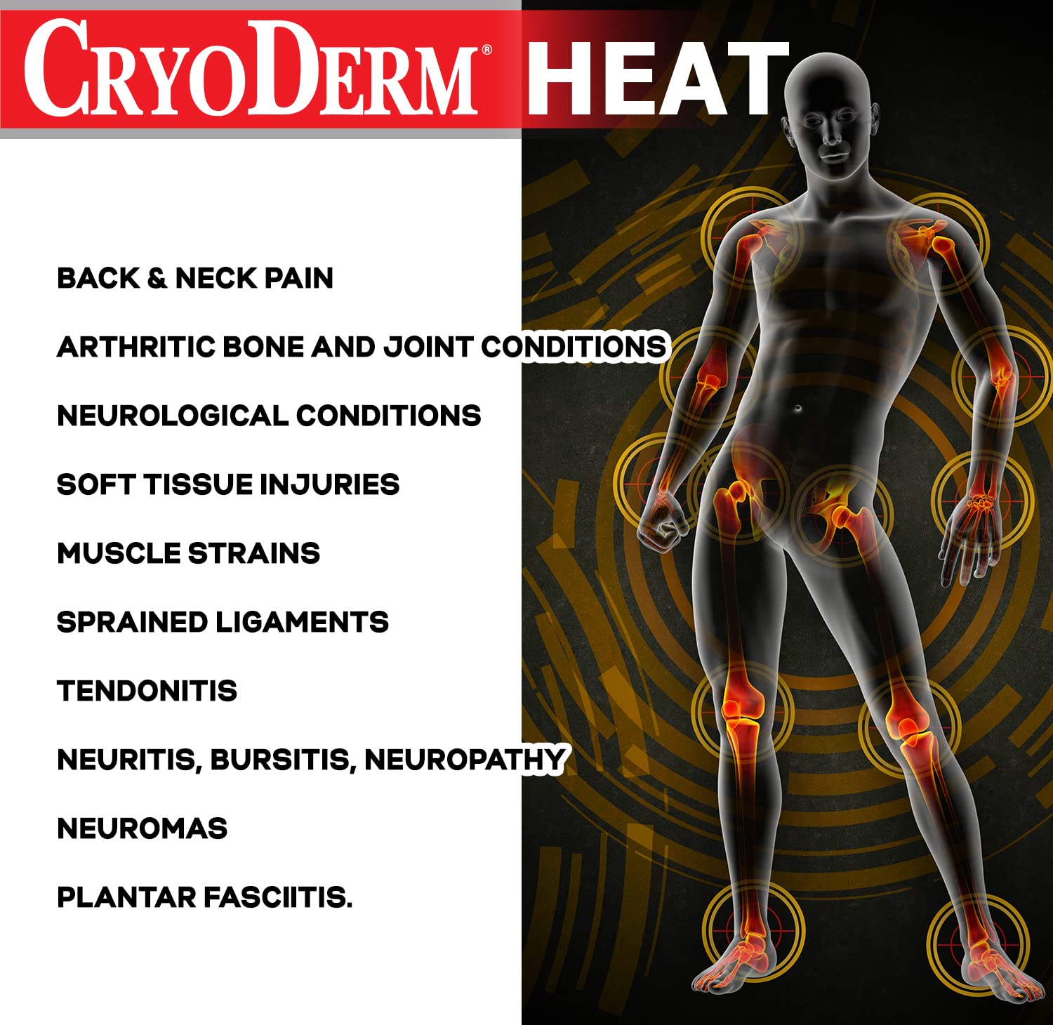 Cryoderm Heat Roll-On 3 oz.