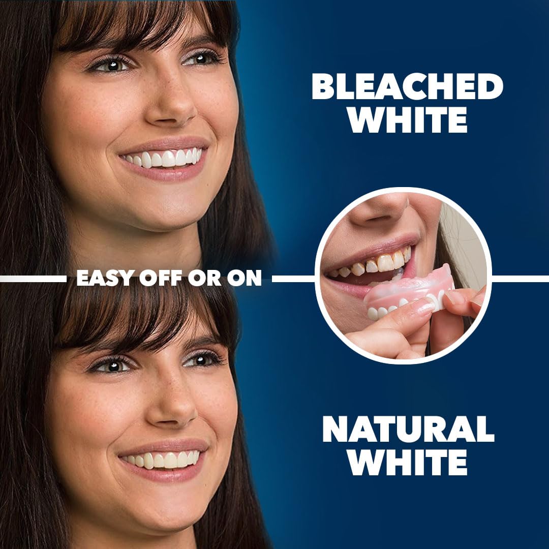Imako Premium Cosmetic Uppers - 2 Pack - Large, Bleached White - DIY Smile Makeover - Made in USA