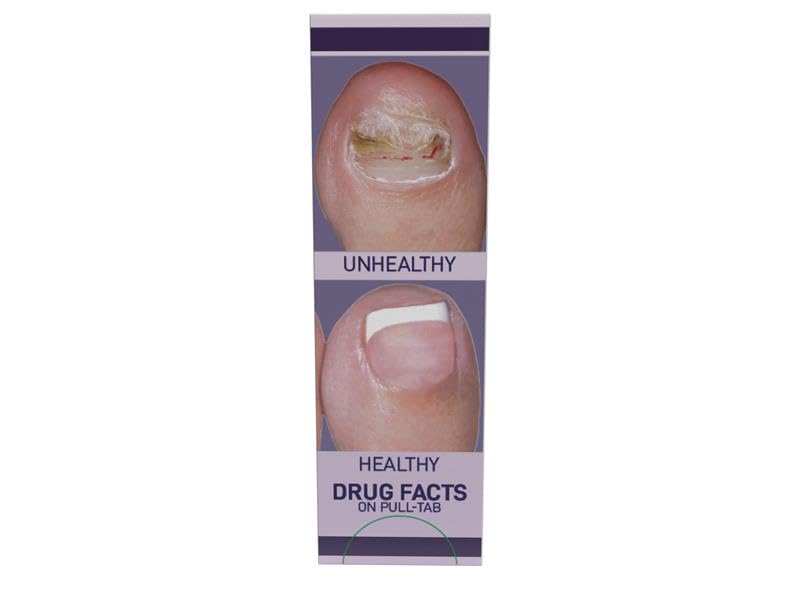 V20 Vite 20 Antifungal Cream Fungus Killer Hand and Feet Nail Treatment