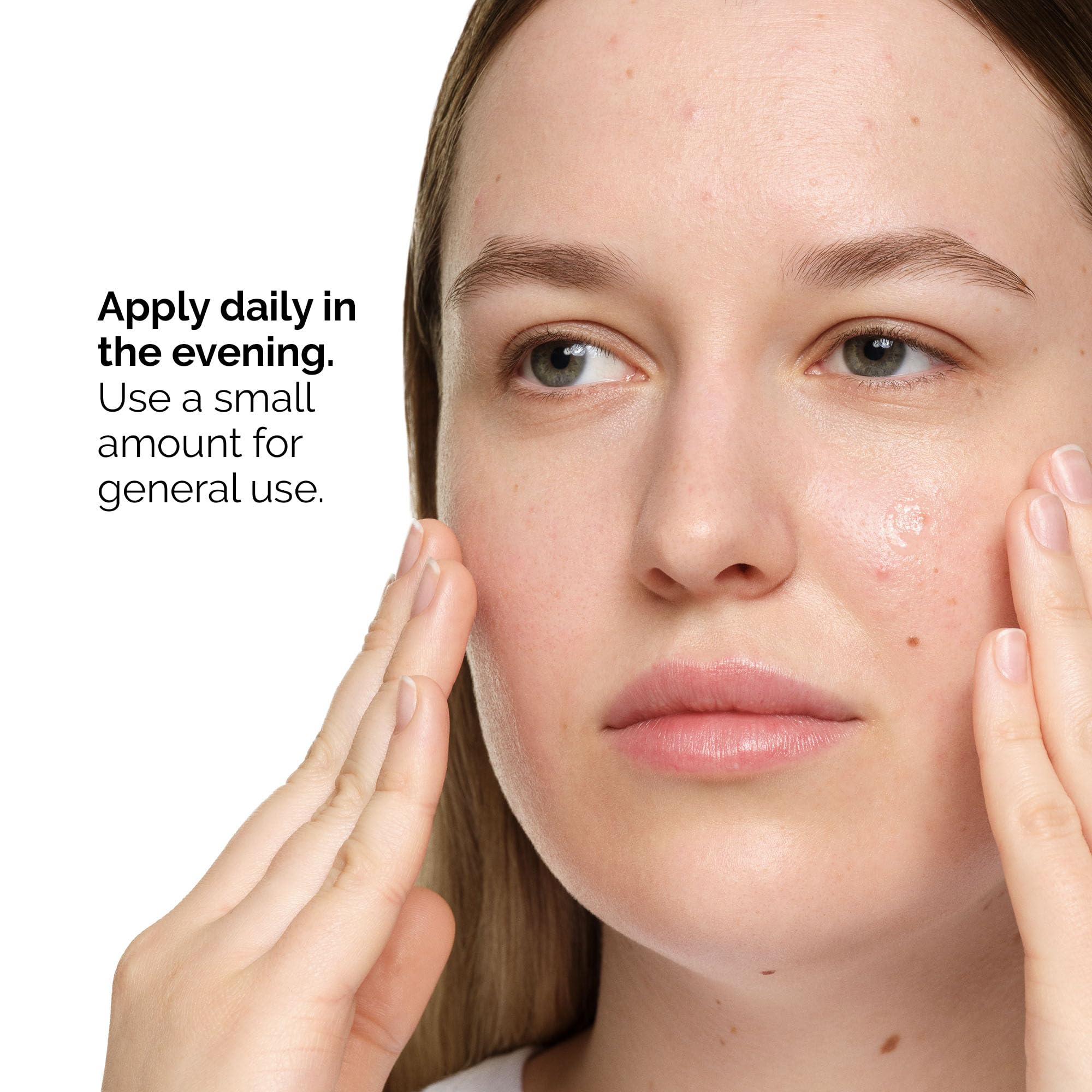 The Ordinary Salicylic Acid 2% Anhydrous Solution, Gentle Exfoliating Serum for Blemish-Prone Skin and Uneven Texture, 1 Fl Oz