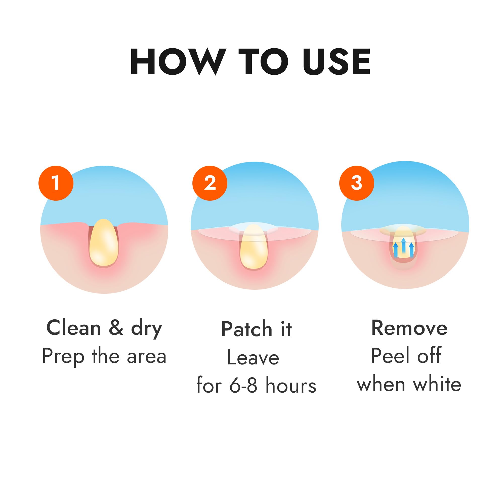 Epielle Over-Zit Acne Variety Patches | 84 Hydrocolloid Acne Pimple Patch for Covering Zits and Blemishes for Full Face (84 Counts), Easter Gift