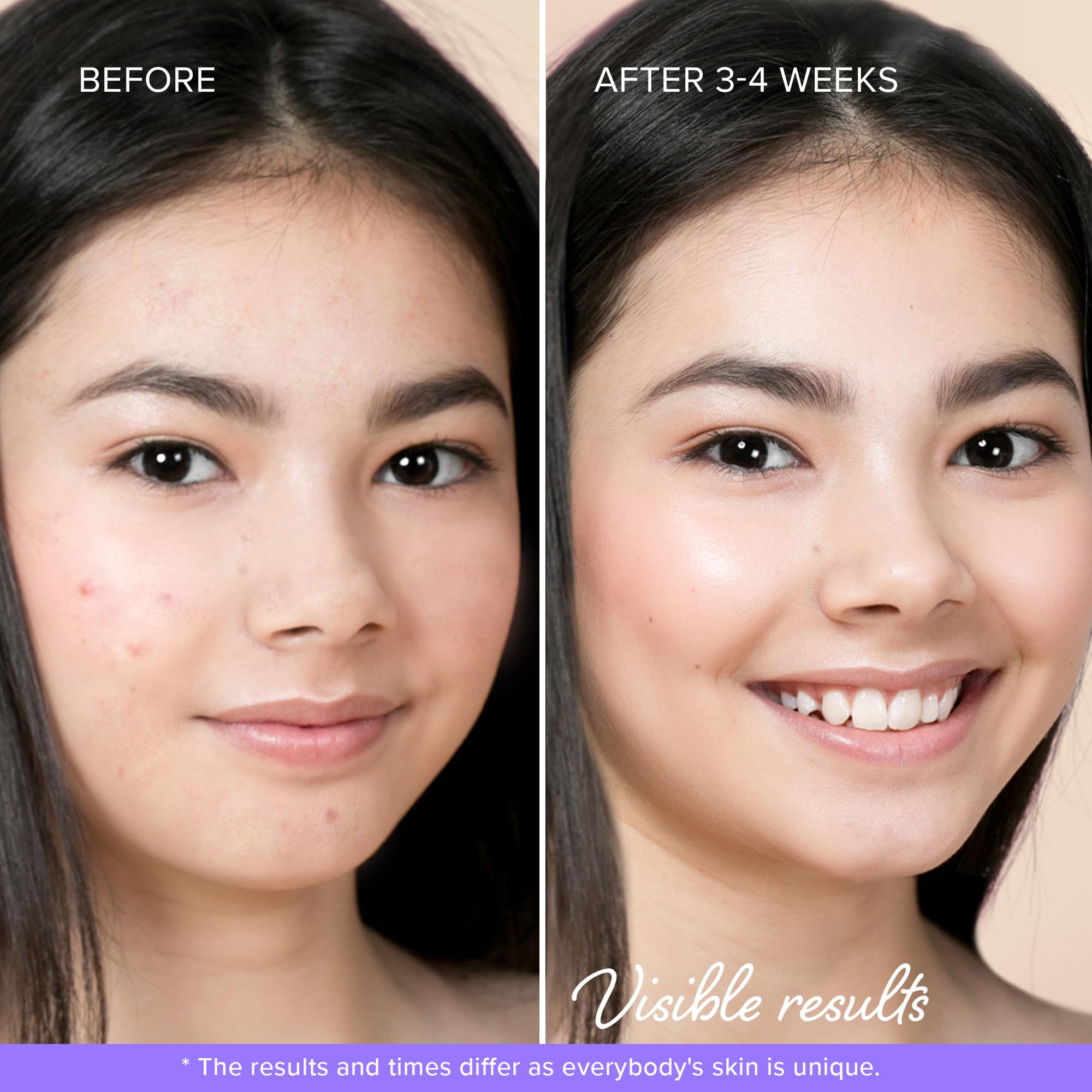 MAREE Star Pimple Patches for Face - Acne Patches - Natural Green Algae Extract & Tea Tree Oil - Hydrocolloid Stars Cute Zit Stickers, Parches Para Acne - 72 Marine Collagen Blemish Pimple Dots