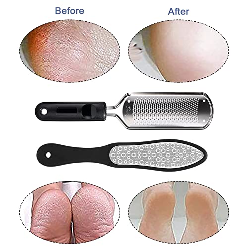 Oneleaf 2PCS Professional Pedicure Rasp Foot File Cracked Skin Corns Callus Remover for Extra Smooth and Beauty Foot (Black) (Black)