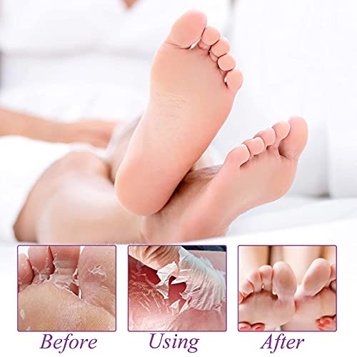 WEIDA SIGN Foot Peel Mask 3 Pack,For Cracked Heels, Dead Skin & Calluses - Exfoliator Remove Repair Rough Heels,Make Your Feet Baby Soft & Get a Smooth Skin (Lavender)