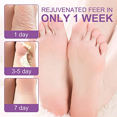 WEIDA SIGN Foot Peel Mask 3 Pack,For Cracked Heels, Dead Skin & Calluses - Exfoliator Remove Repair Rough Heels,Make Your Feet Baby Soft & Get a Smooth Skin (Lavender)