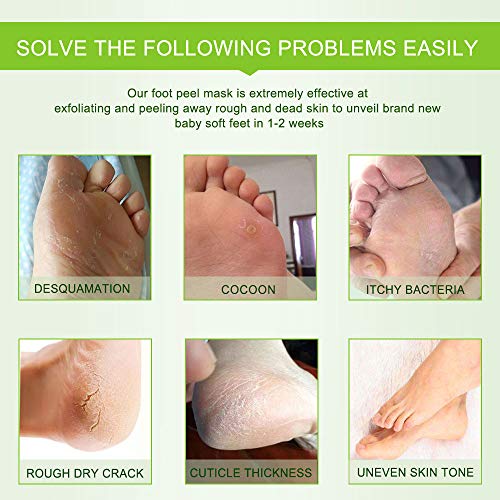 Foot Peel Mask 3 Pack,Remove Callus & Repair rough heals-Men Women (Cucumber)