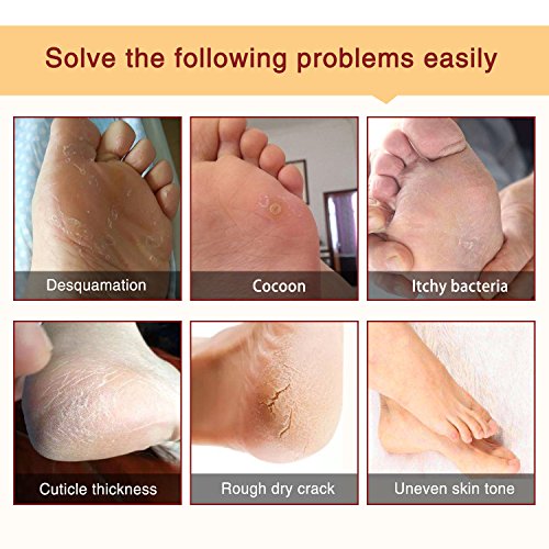 Foot Peel Mask 3 Pack, Exfoliator Peel Off Calluses Dead Skin Callus Remover,Baby Soft Smooth Touch Feet-Men Women (Lavender)