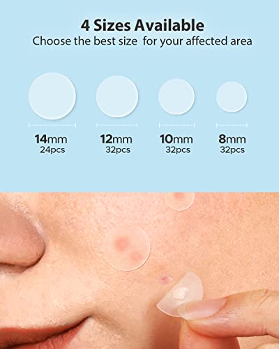LitBear Acne Pimple Patches- Day and Night 4 Sizes 180 Dots Thin & Thick Hydrocolloid Patches with Witch Hazel, Tea Tree & Calendula Oil, Extra Adhesion Pimple Patches for Face Zit Patch Acne Dots