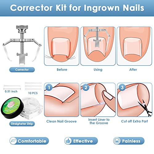 8 PCS Toenail Clippers Kit for Thick or Ingrown Nails, Professional Heavy Duty Ingrown and Thick Toenail Clippers, Sharp Stainless Steel Nail Cutter Set Toenail Pedicure Treatment Tool for Elderly