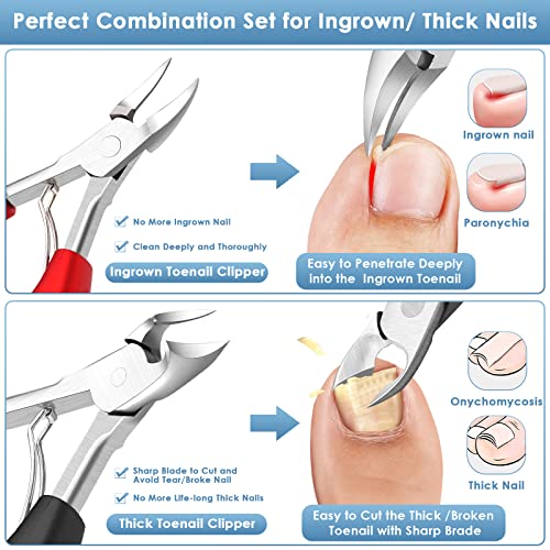 8 PCS Toenail Clippers Kit for Thick or Ingrown Nails, Professional Heavy Duty Ingrown and Thick Toenail Clippers, Sharp Stainless Steel Nail Cutter Set Toenail Pedicure Treatment Tool for Elderly