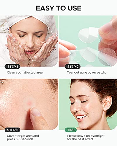 ZATKTK Acne Pimple Patch (180 Counts 4 Sizes), Invisible Hydrocolloid Acne Patch with Tea Tree Oil & Calendula Oil, Acne Spot Healing Patch Zit Patches for Face