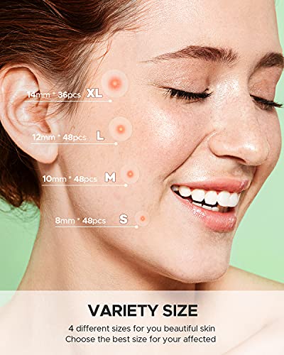 ZATKTK Acne Pimple Patch (180 Counts 4 Sizes), Invisible Hydrocolloid Acne Patch with Tea Tree Oil & Calendula Oil, Acne Spot Healing Patch Zit Patches for Face