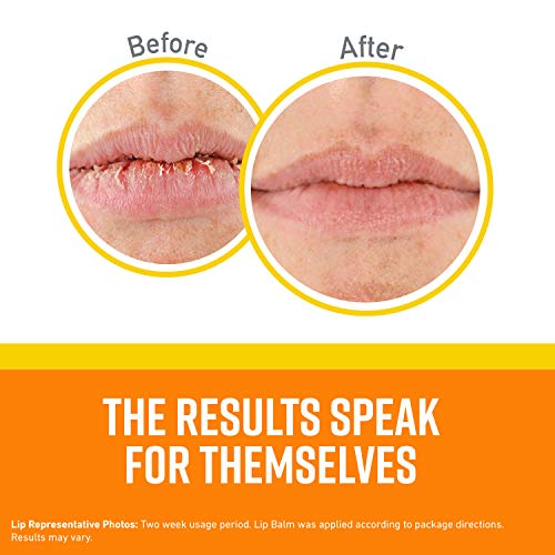 O'Keeffe's Lip Repair SPF 35 Lip Balm Stick, (Pack of 3)