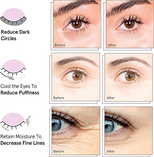 Grace & Stella Under Eye Mask (24 pairs, Blue) + Foot Peel Mask (4 Pairs, Unscented)