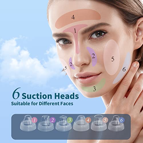 Blackhead Remover Wurkkos Pore Vacuum with Camera Black Head Remove Tools Acne Comedone Pimple Extractor with 6 Suction Heads for Phone,Tablet PC,Computer Facial Suctioner for Women & Men(Pink)