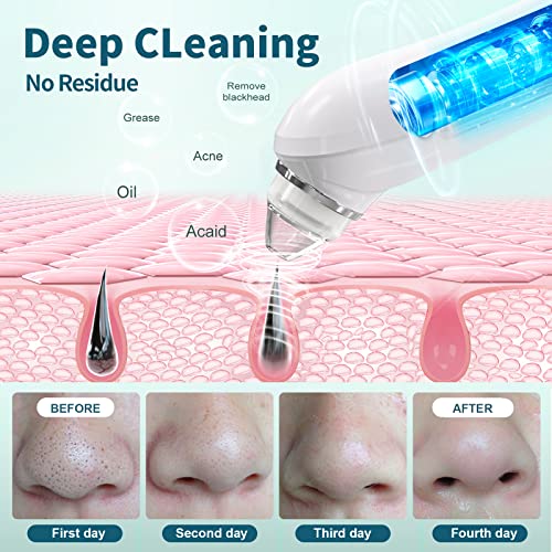 Blackhead Remover Wurkkos Pore Vacuum with Camera Black Head Remove Tools Acne Comedone Pimple Extractor with 6 Suction Heads for Phone,Tablet PC,Computer Facial Suctioner for Women & Men(Pink)