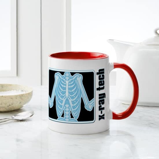 CafePress X Ray Tech Mug Ceramic Coffee Mug, Tea Cup 11 oz