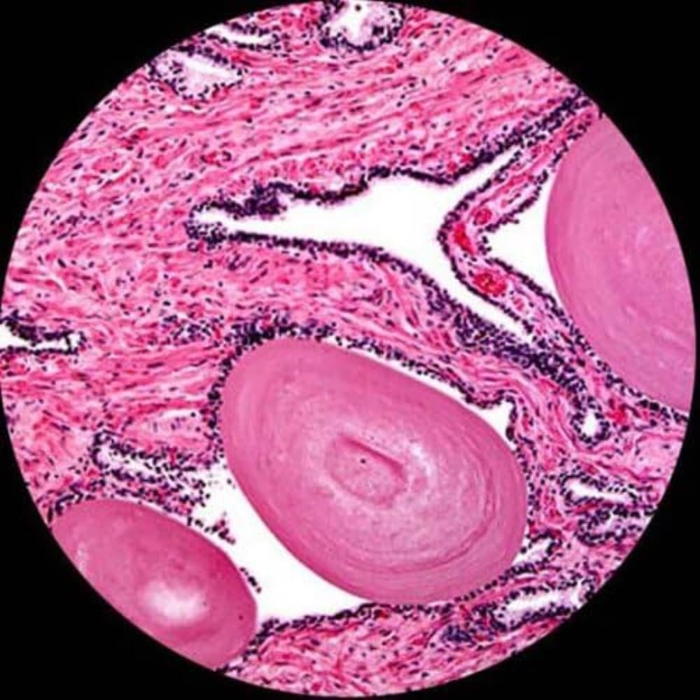 AmScope T360B-10M Digital Trinocular Compound Microscope, 40X-2000X Magnification, WF10x and WF20x Eyepieces, Brightfield, LED Illumination, Abbe Condenser, Double-Layer Mechanical Stage, Includes 10MP Camera with Reduction Lens and Software