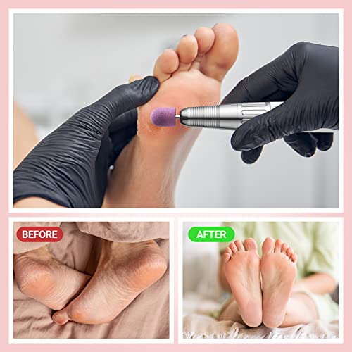 MelodySusie 10 Pcs Nail Sanding Caps Nail Drill Bits 180 Fine Grit for Foot File Callus Remover Manicure Pedicure Nail Polishing Burr Home Salon, Purple (10mm)