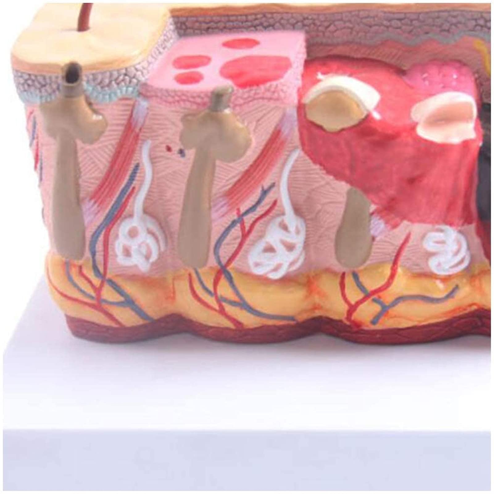 HAILIA Study Model Educational Model Skin Anatomical ModelMedical Anatomical Skin Model Burn Skin Anatomy Model for Study Display Medical Taching Model,Medical Models