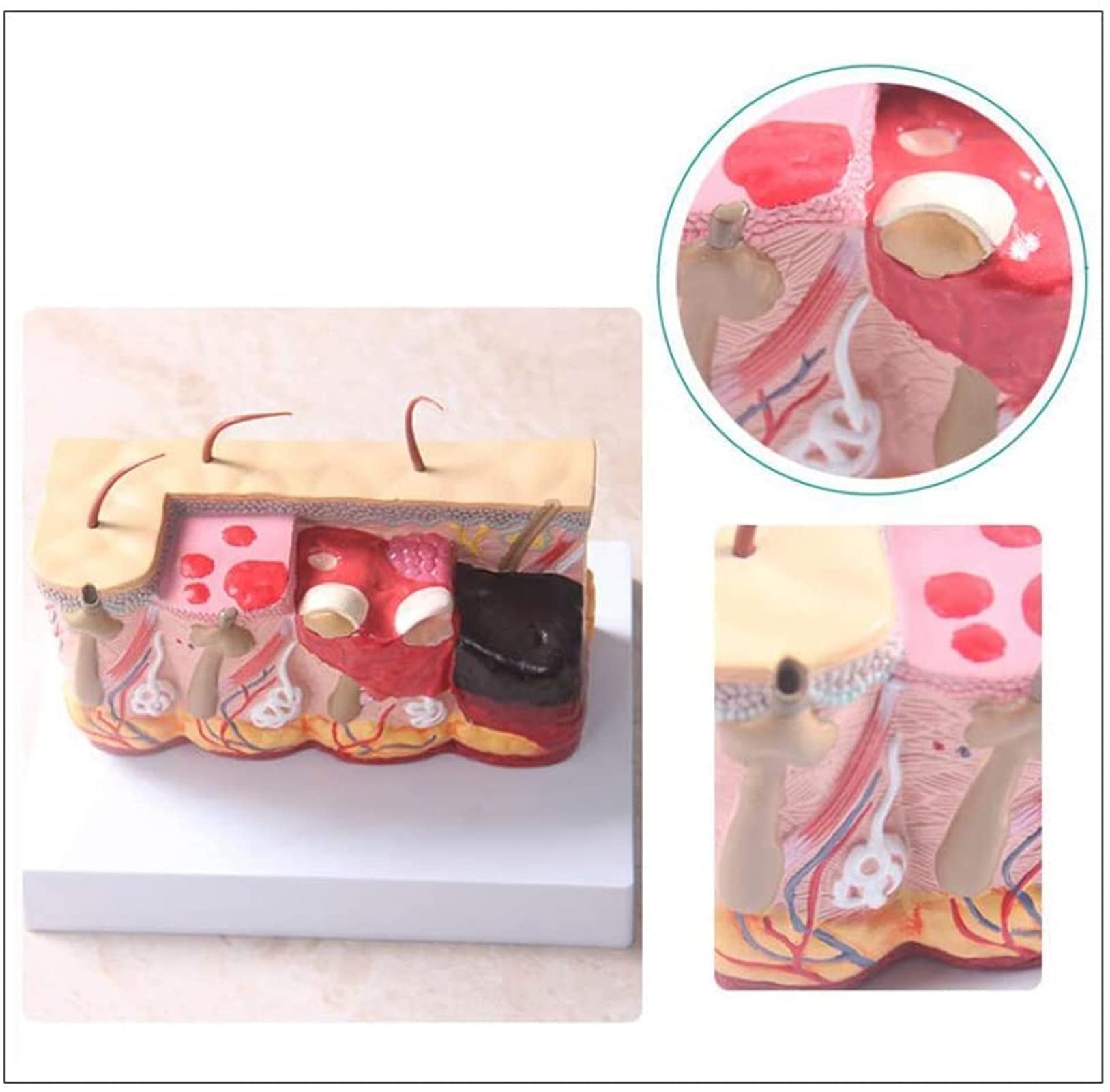 HAILIA Study Model Educational Model Skin Anatomical ModelMedical Anatomical Skin Model Burn Skin Anatomy Model for Study Display Medical Taching Model,Medical Models