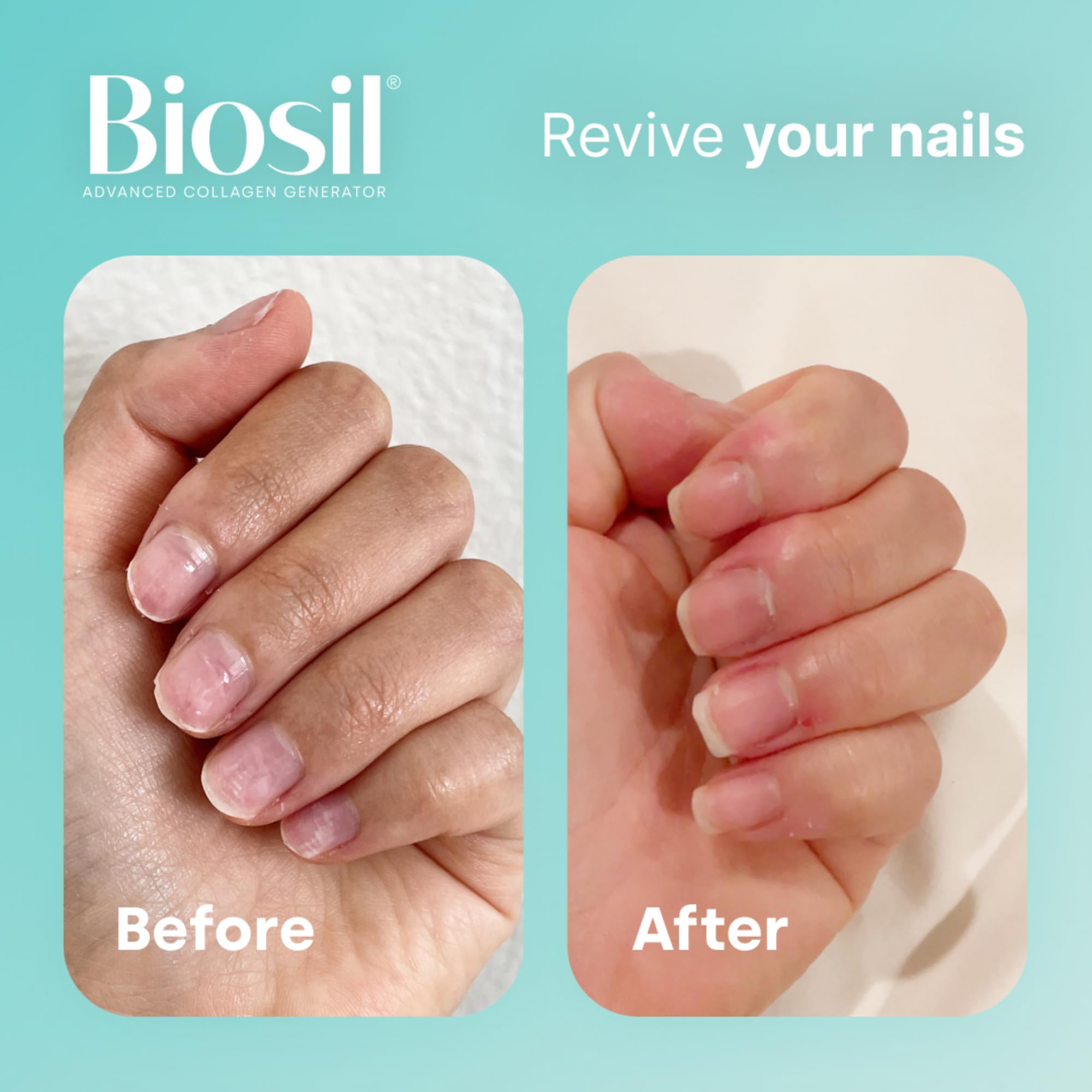 Biosil Collagen Generator - 60 Liquid Capsules - with Patented ch-OSA Complex - Generates & Protects Your Own Collagen - GMO Free - 30-Day Supply
