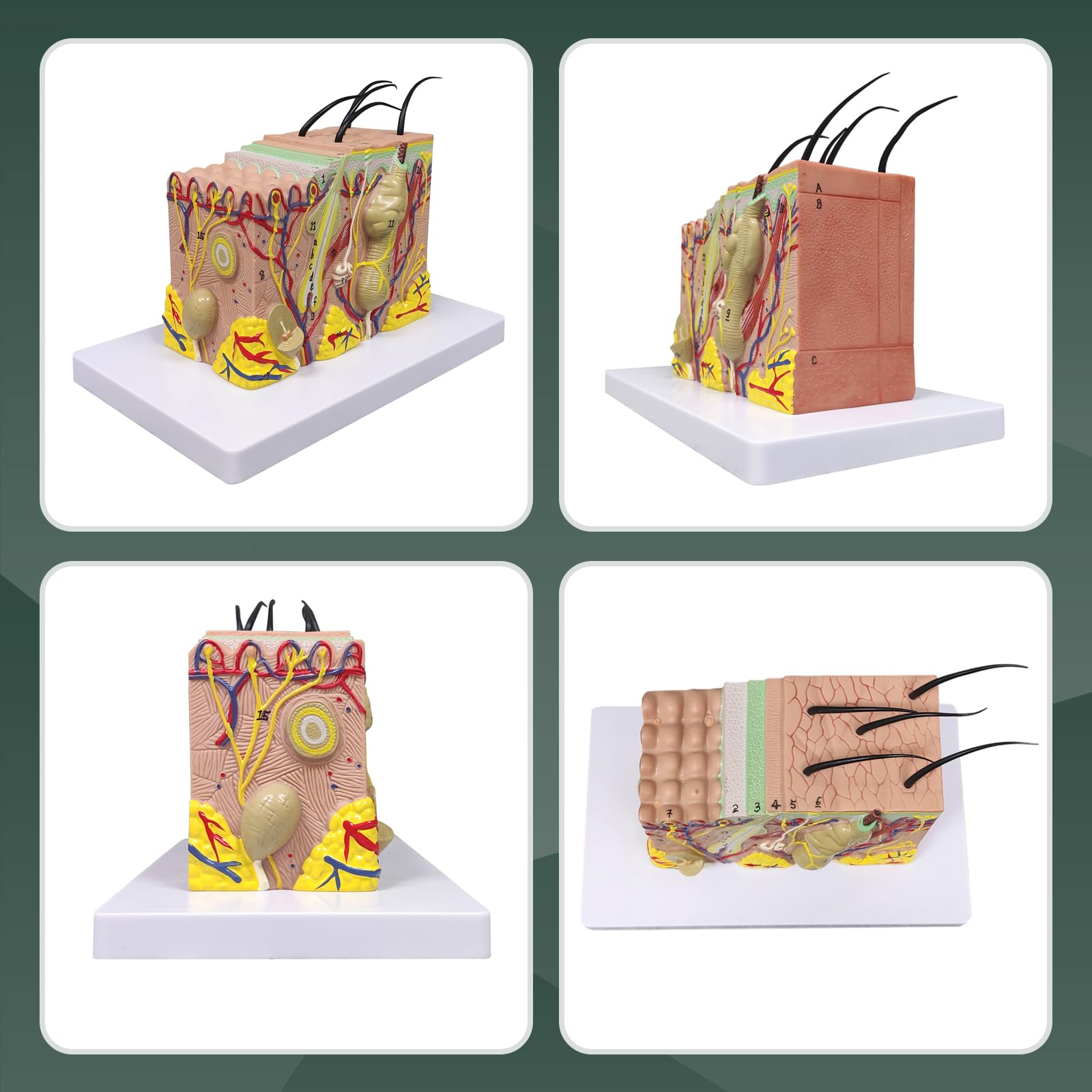 Ultrassist Skin Anatomy Model with A Study Guide, 35 Times Enlarged Anatomical Skin Model, Teaching Tool for Science Study or Patient Education