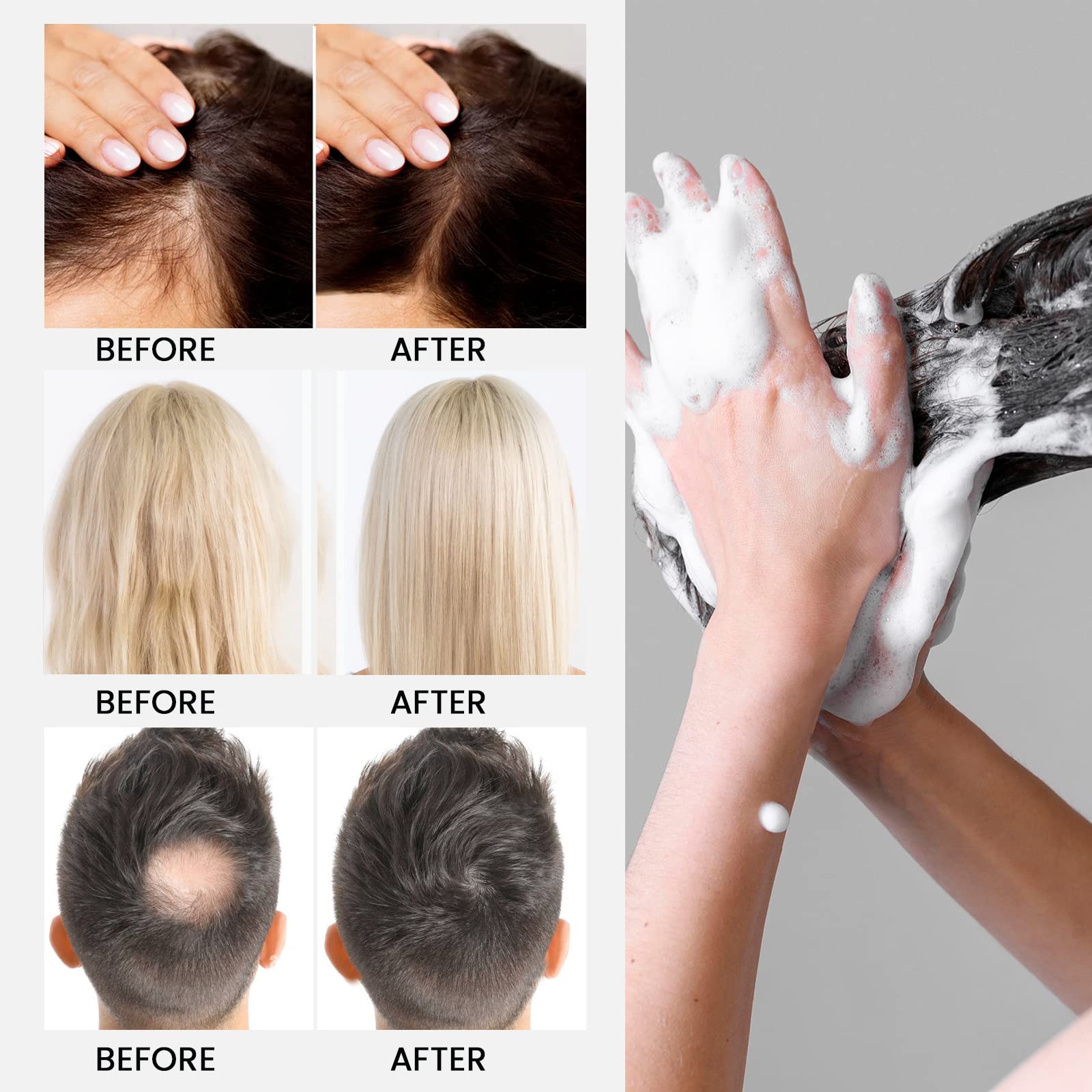 Rice Water for Hair Growth Shampoo Thinning and Loss Women, Rosemary Oil & Biotin Growth, Anti Regrowth Men, All Types
