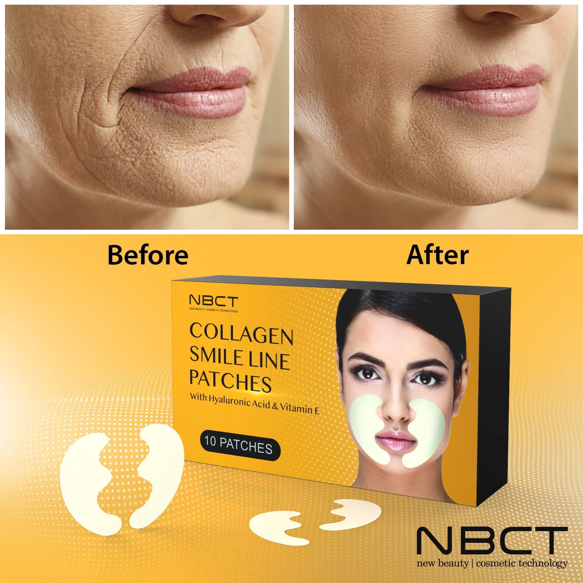 NBCT Collagen Smile Line Wrinkle Patches with Hyaluronic Acid, Aloe Vera, Vitamin E, Skin Safe & Botox Alternative