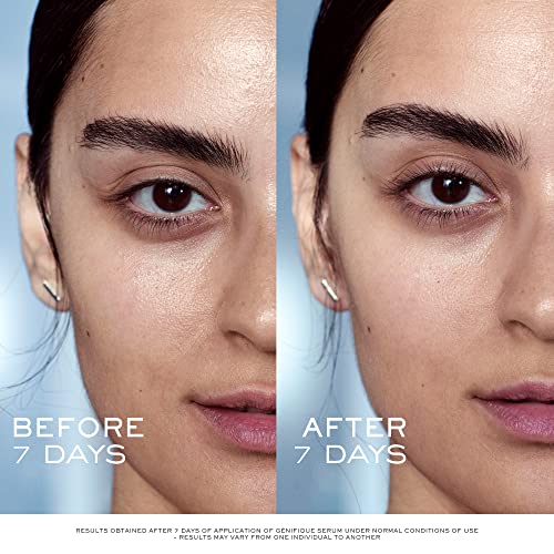 Lancôme Advanced Génifique Face Serum - For Fine Lines & Boosts Radiance - With Bifidus Prebiotic, Hyaluronic Acid & Vitamin Cg - 2.5 Fl Oz
